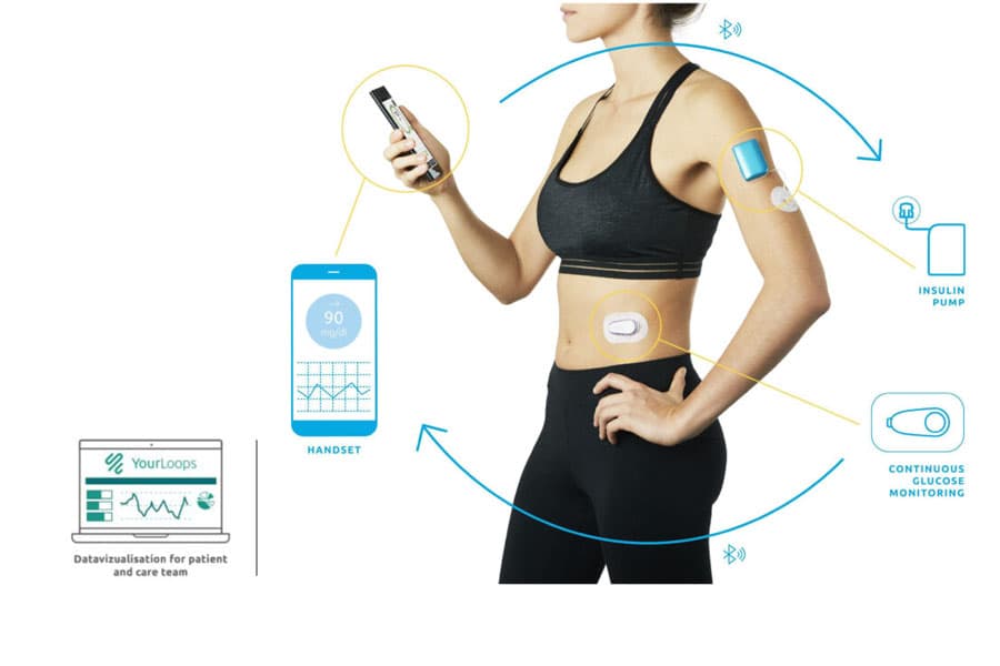 Kaleido Insulin Pump Price in Nepal, Overview and Availability